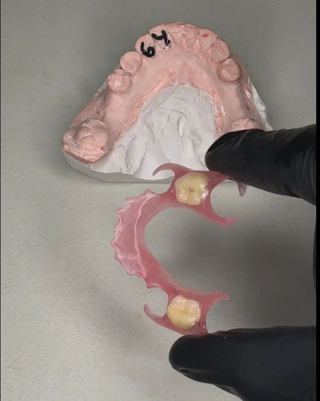 PPR Flex Prótese parcial removível Flexível - Equipamentos Médicos e ...