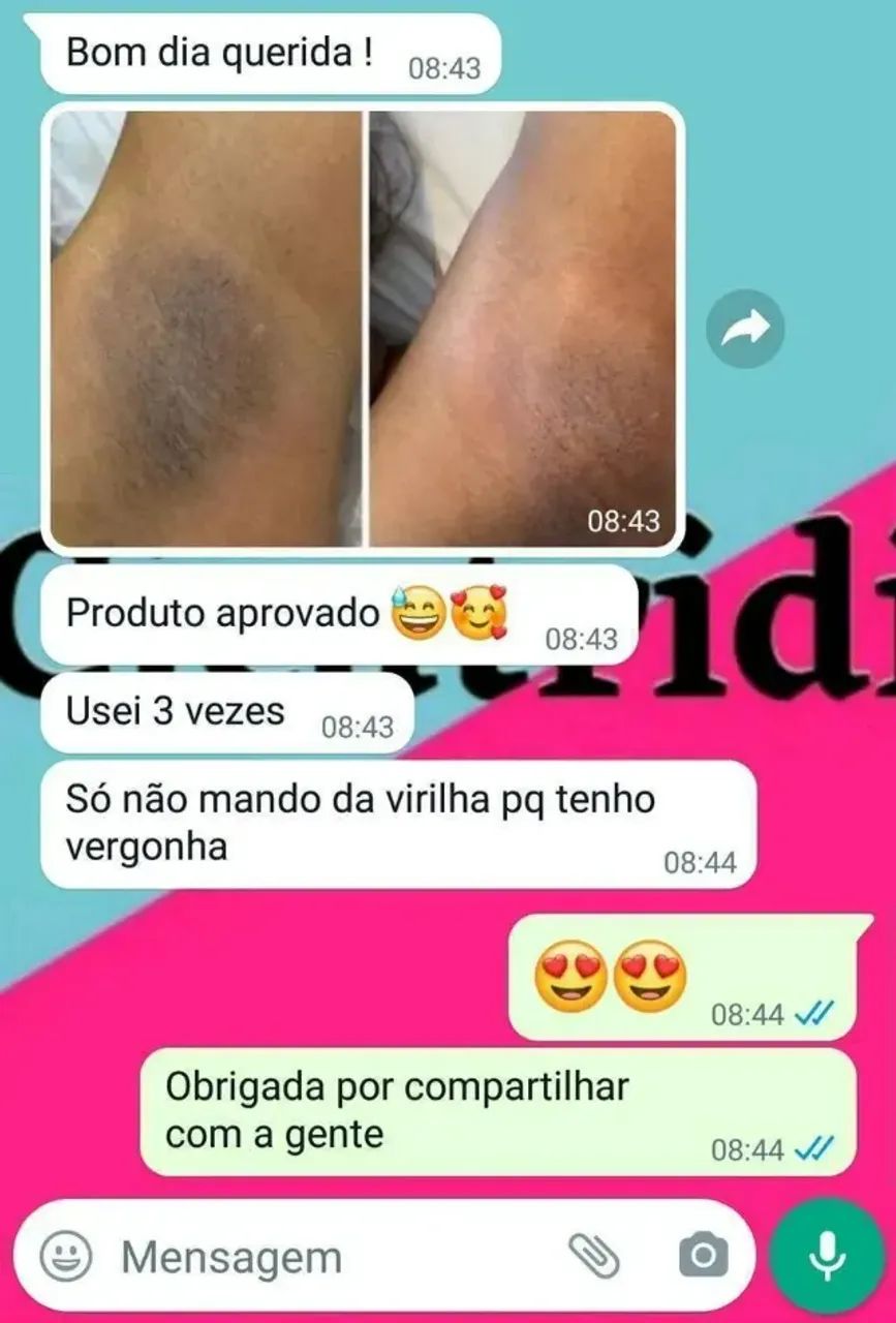 Clareador de Manchas de Pele Amazolé: Liberte Sua Pele das Manchas ...