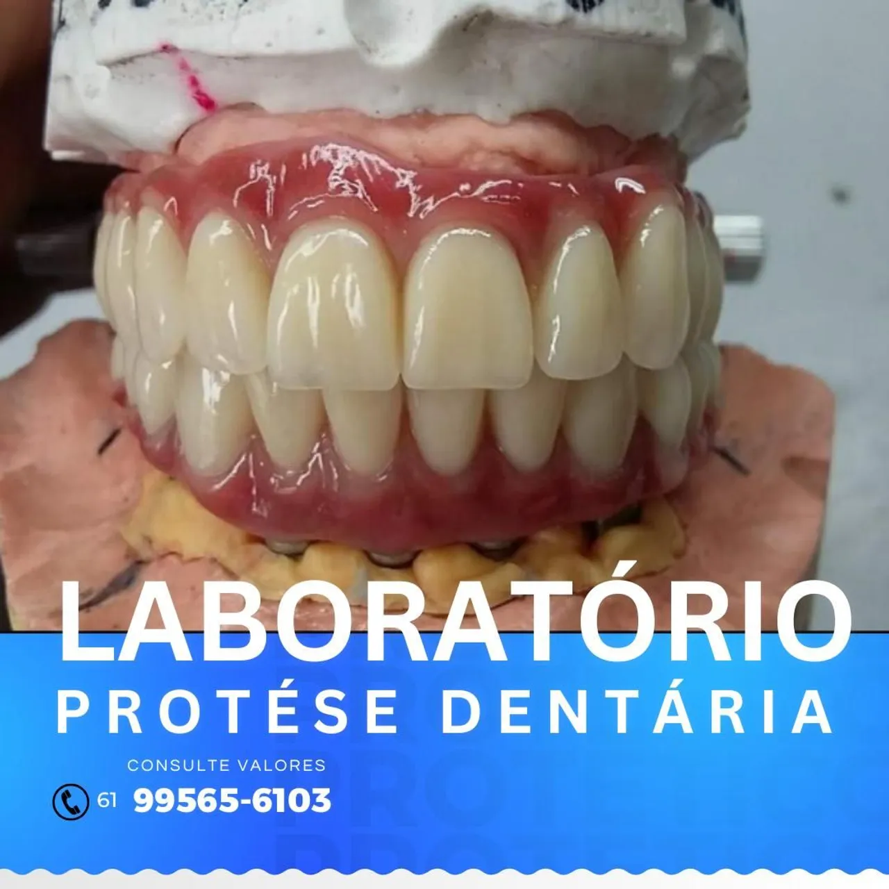 "protetico" no Brasil