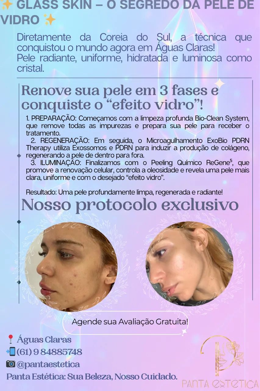 Limpeza de pele/ peeling coreano - Serviços - Santa Maria, Brasília ...