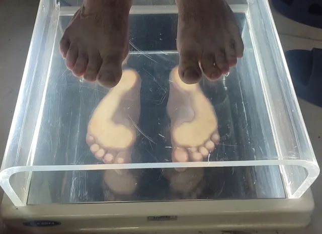 "podoscopio" no Brasil