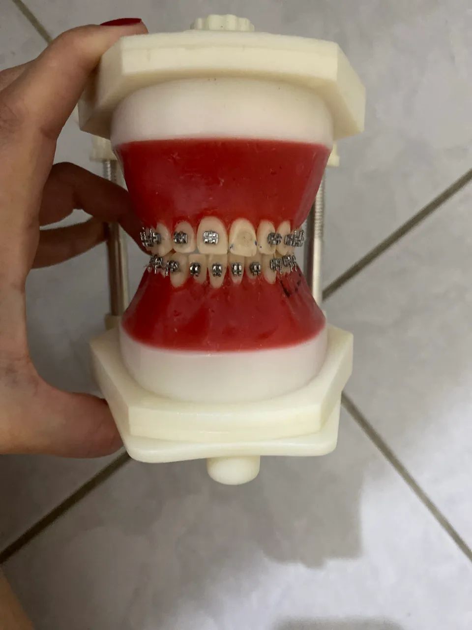 Modelo Odontológico com Aparelho Ortodôntico - Typodont - Equipamentos ...