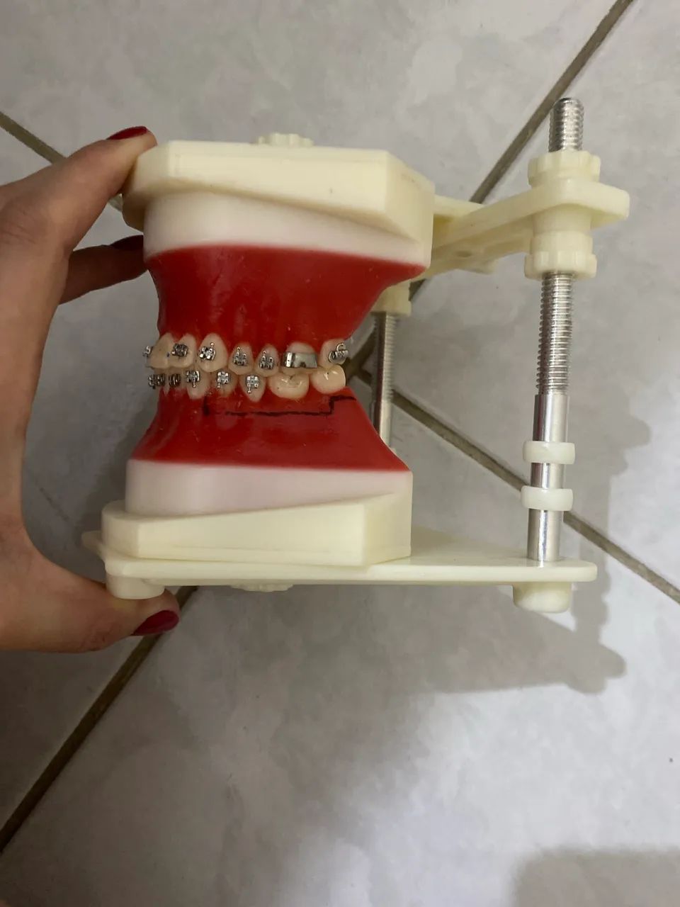 Modelo Odontológico com Aparelho Ortodôntico - Typodont - Equipamentos ...
