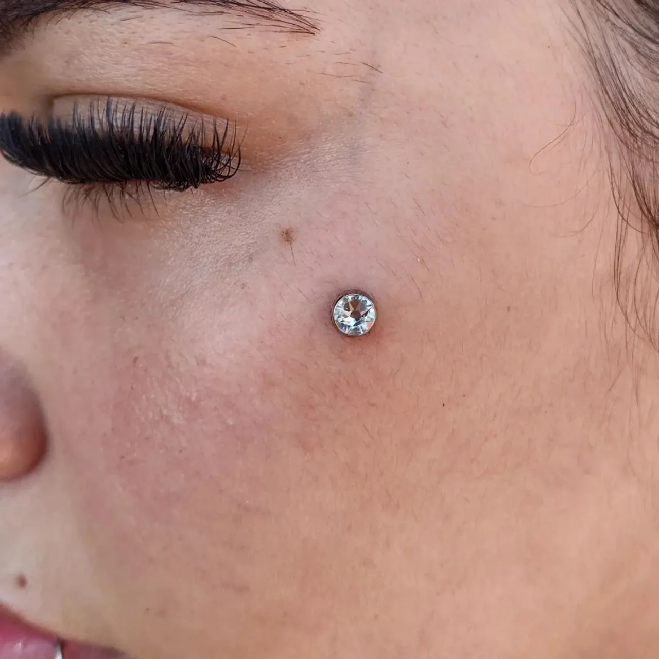 "microdermal" no Brasil